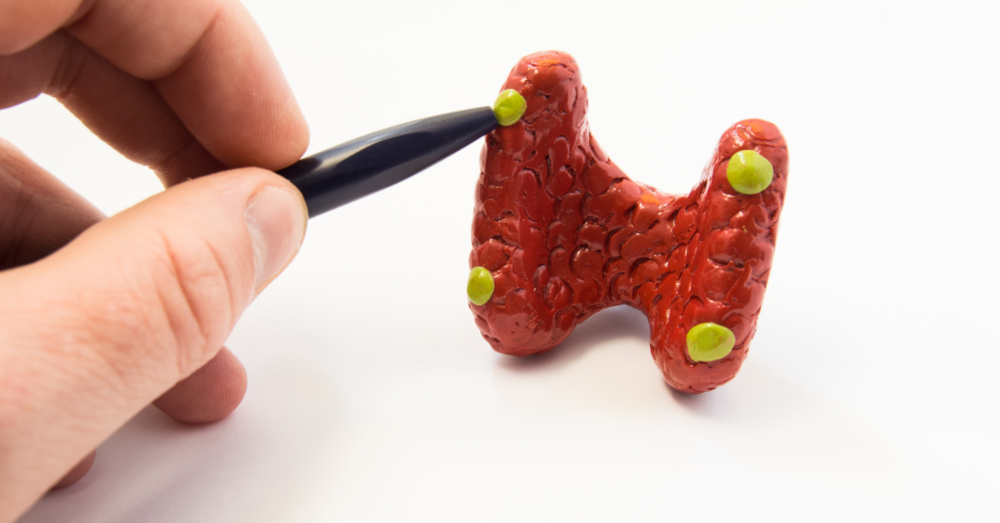 The Treatment of Hyperparathyroidism: Why Surgery is the Only Solution